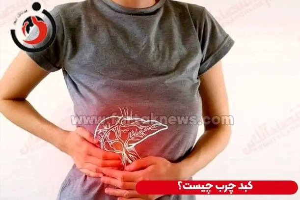 علائم «کبد چرب چیست؟ رژیم غذایی درمانی
